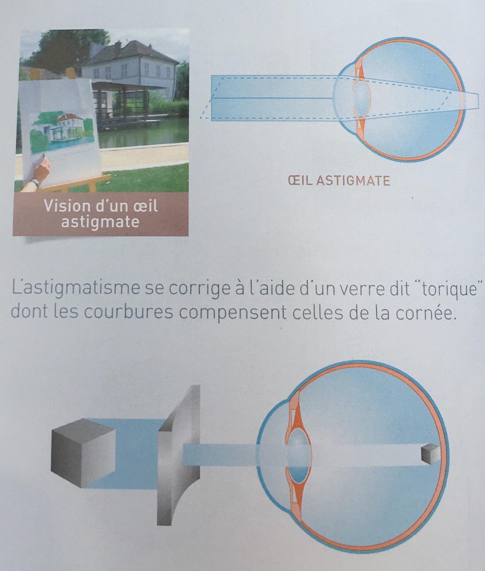 L'astigmatisme - Optique Laurence Taillandier